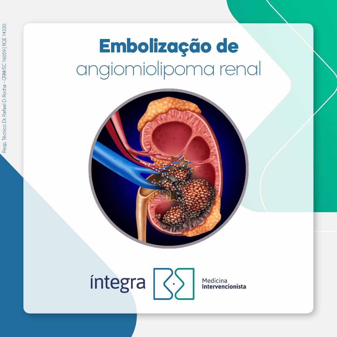 Angiomiolipoma - Tratamento minimamente invasivo